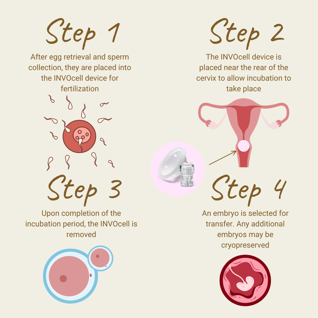 Everything You Need to Know About INVOcell Fertility Treatment